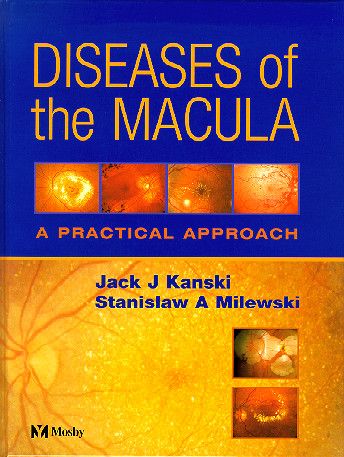 Aantastingen van de gele vlek - Optische Fenomenen